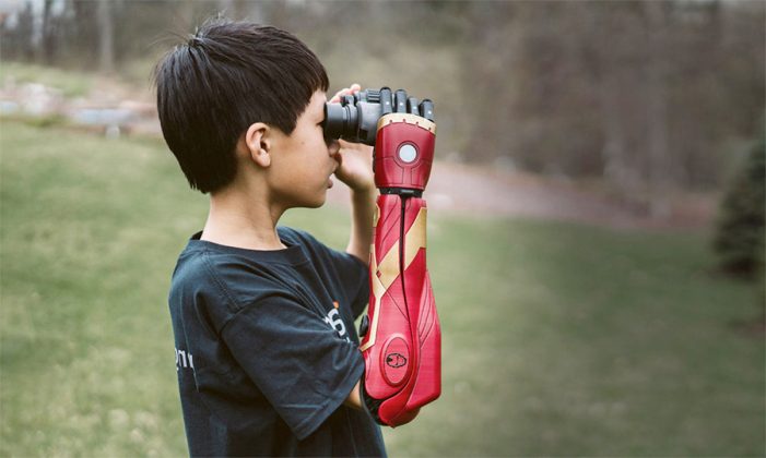 The Hero Arm™: A revolutionary bionic arm for people with limb differences