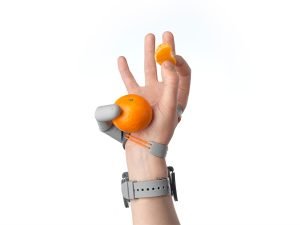 3D-printed robotic thumb changing the game for prosthetics and beyond