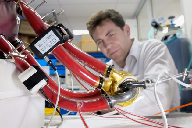 Patient discharged with maglev titanium heart cycling inside his chest
